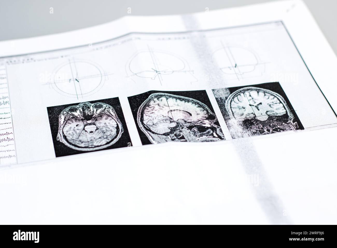 Baby brain scan hi-res stock photography and images - Alamy