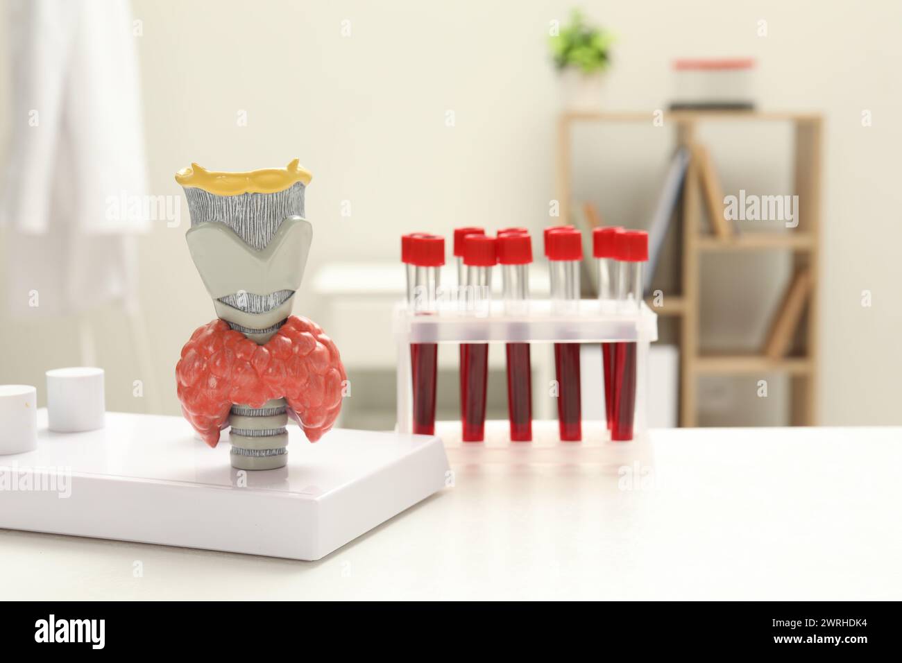 Endocrinology. Model of thyroid gland and samples of blood in test ...