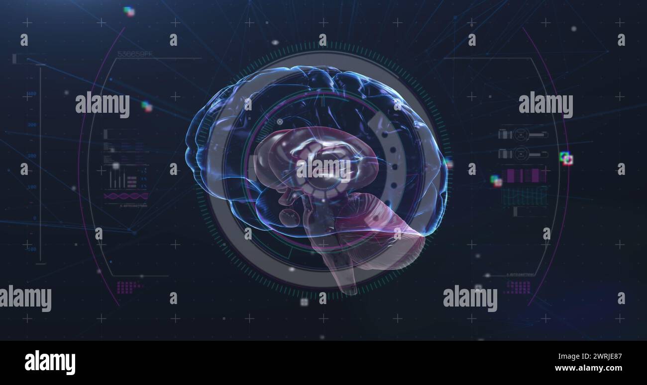 Human brain scan development hi-res stock photography and images - Alamy