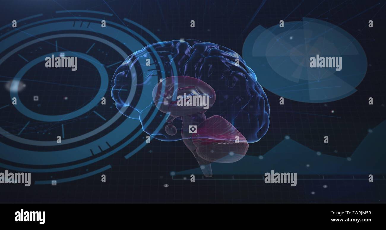 Image of scopes scanning and human brain spinning with flickering spots ...