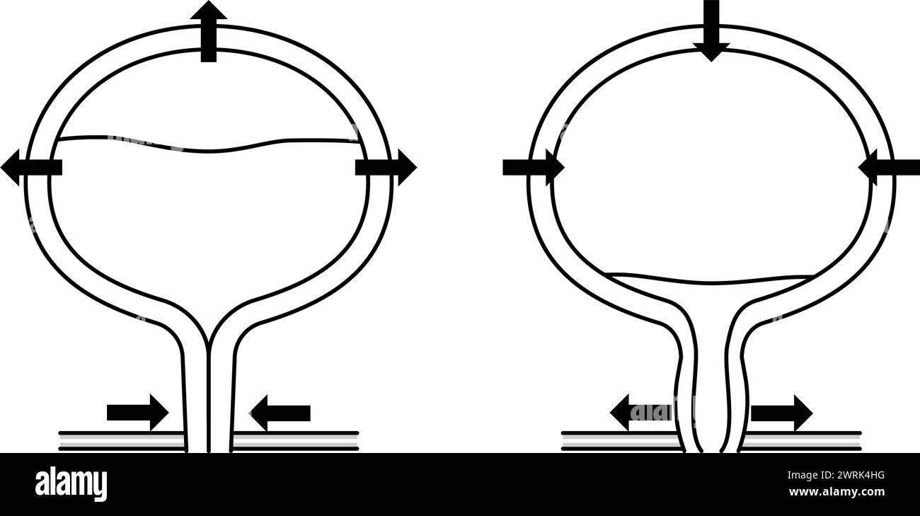 Medical Illustration of the Normal Bladder, Mechanism of Urination ...