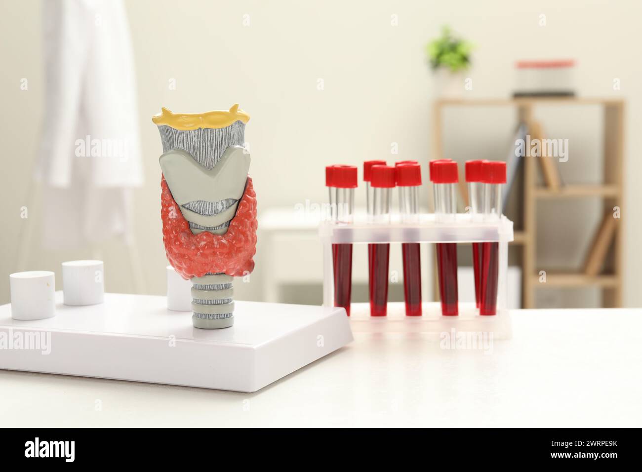 Endocrinology. Model of thyroid gland and samples of blood in test ...