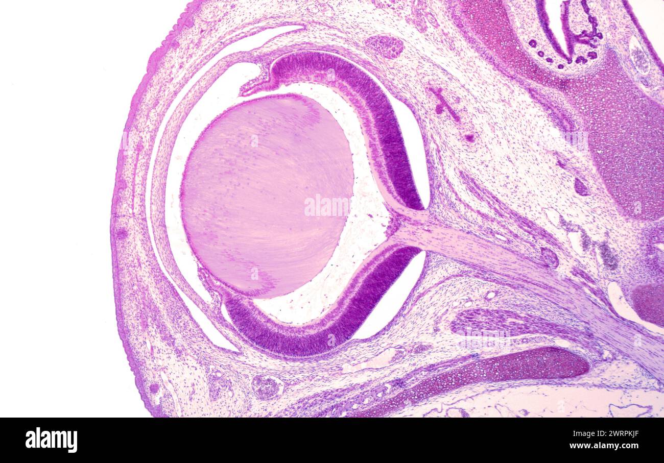 Developing rat eye, light micrograph Stock Photo - Alamy