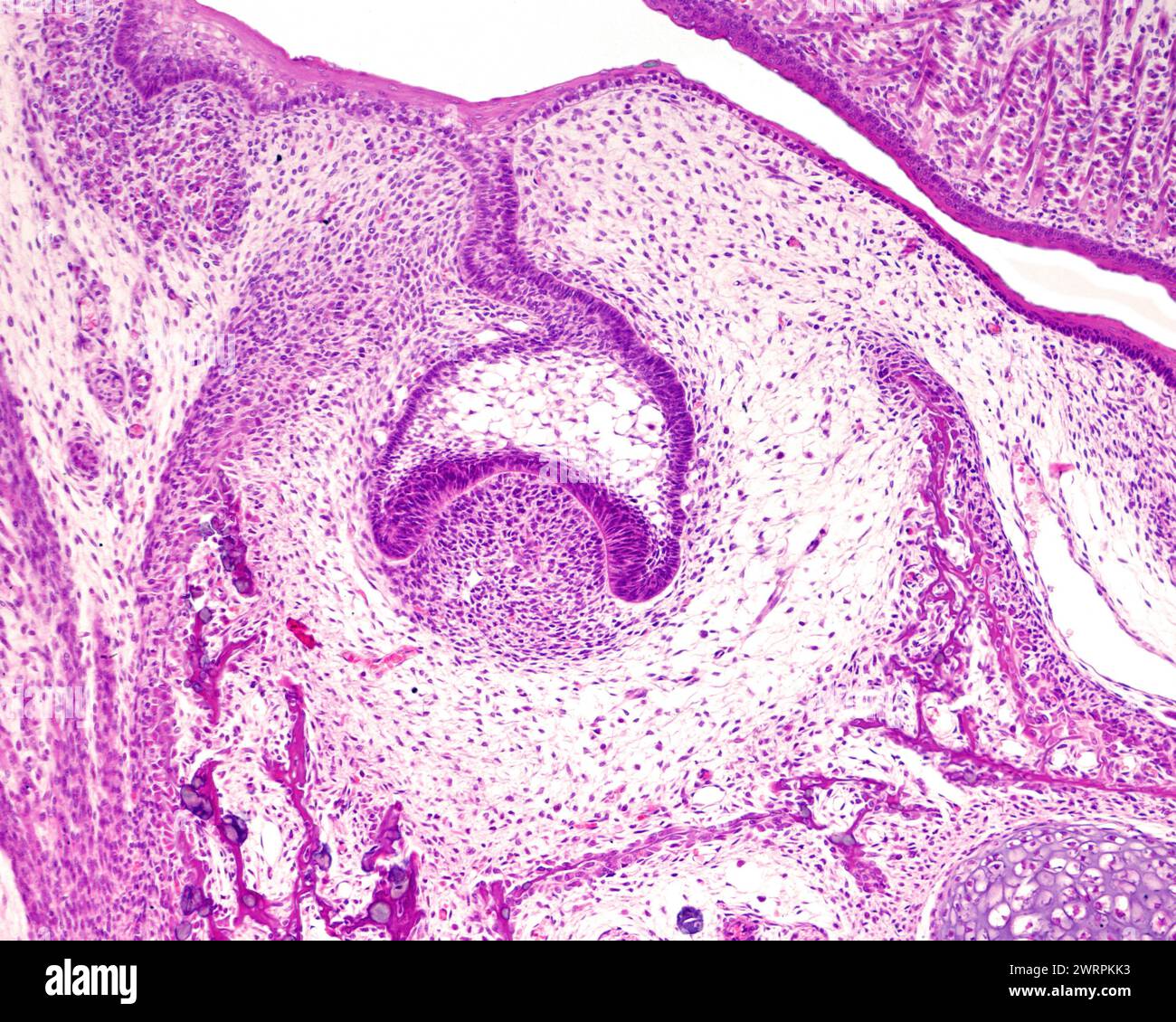 Developing tooth, light micrograph Stock Photo - Alamy