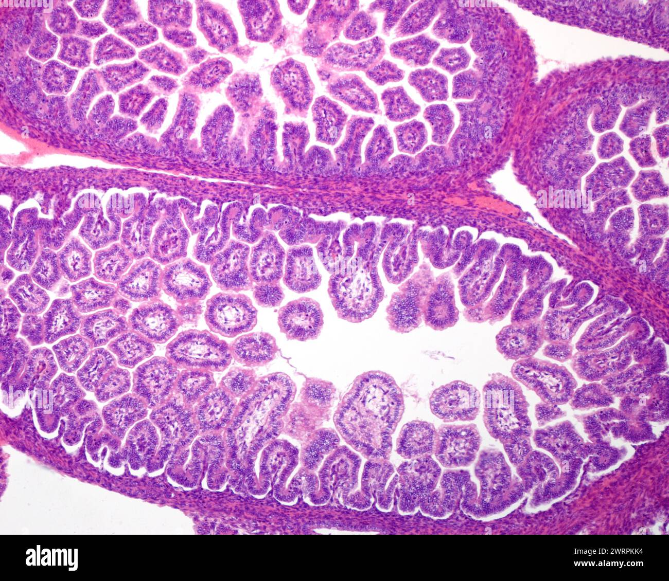 Foetal small intestine, light micrograph Stock Photo - Alamy