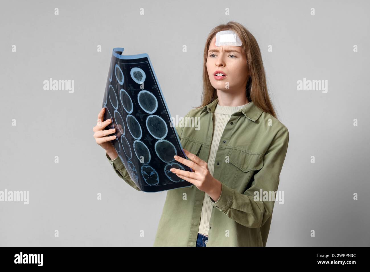 Young woman with brain concussion and MRI scan on light background ...
