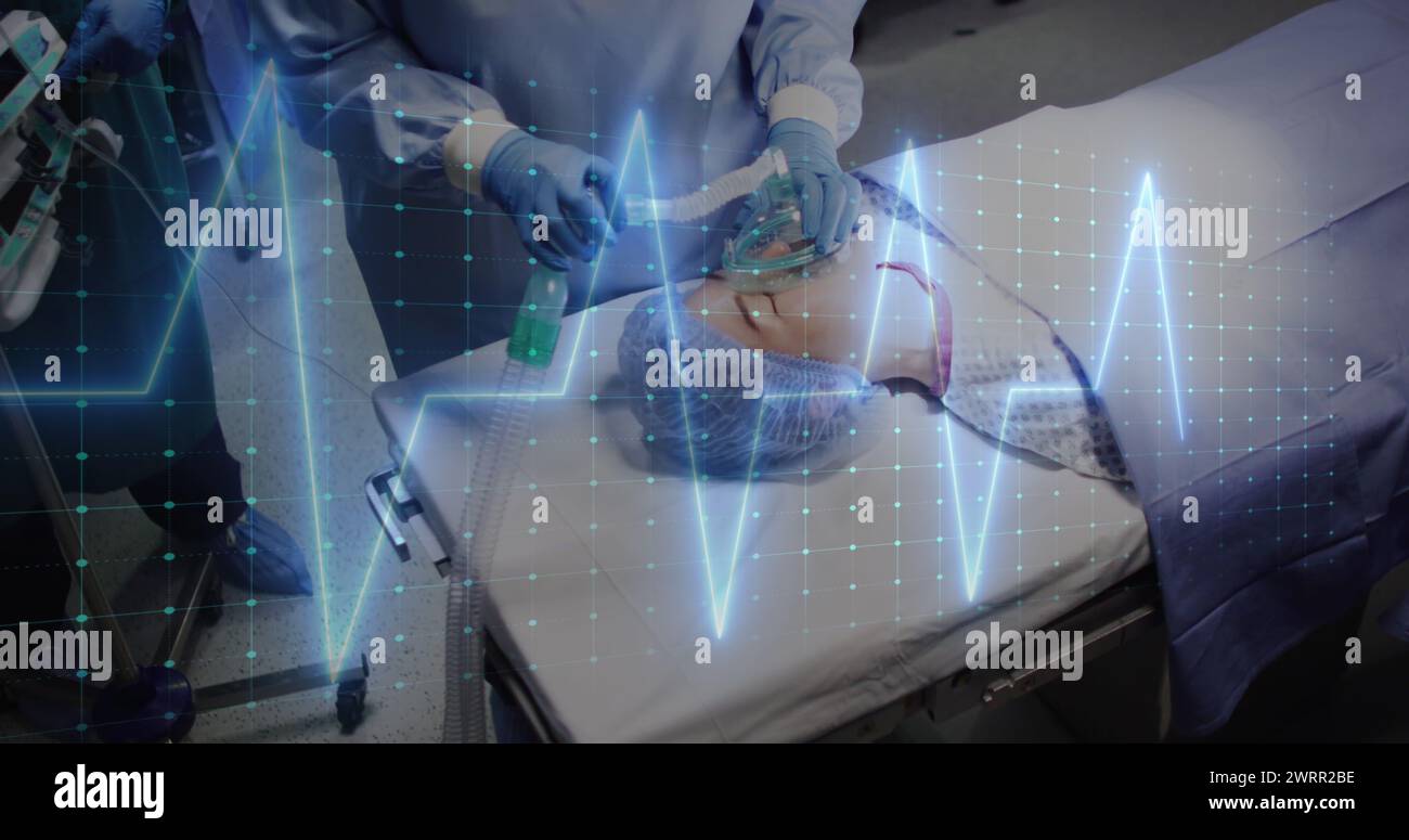 Image of cardiograph over diverse surgeons operating on patient at ...