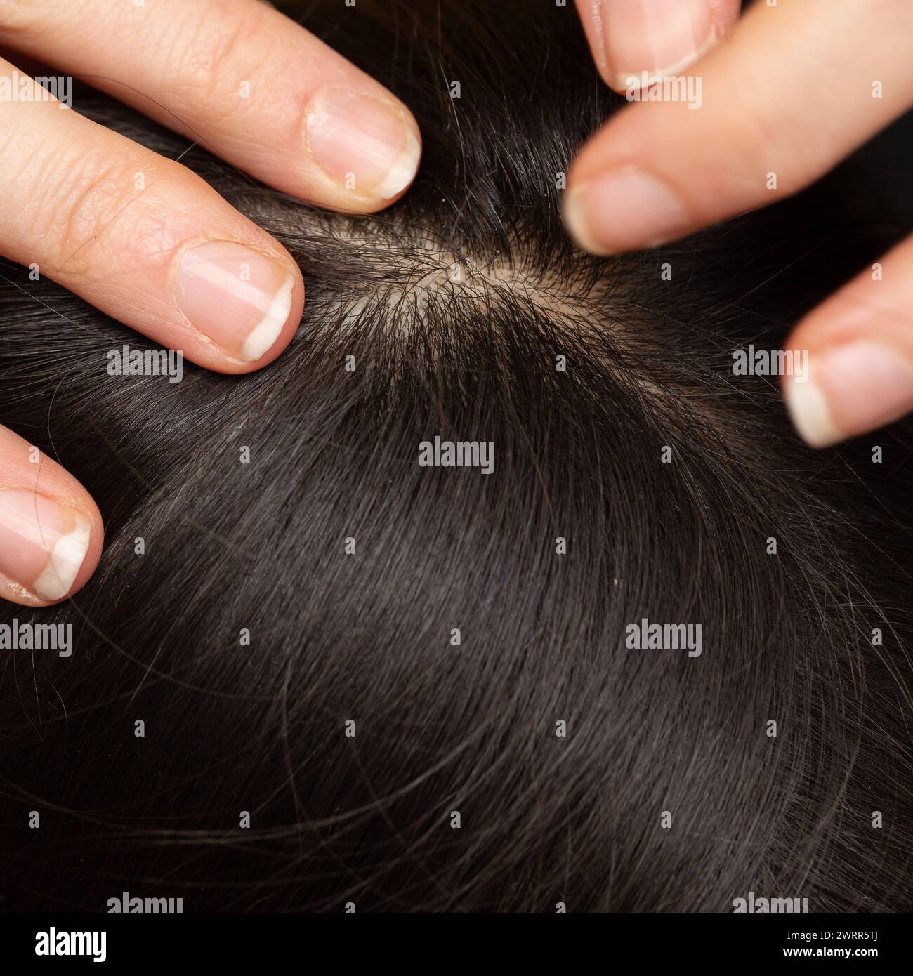 Scalp inspection hi-res stock photography and images - Alamy