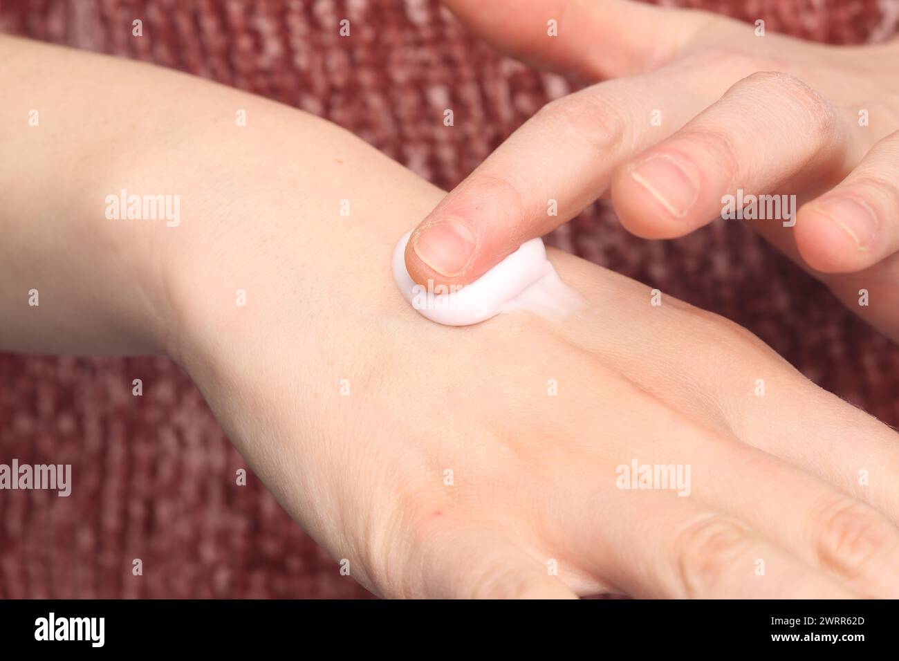 Woman's hand applying moisturizing cream on her arm to nourish and ...
