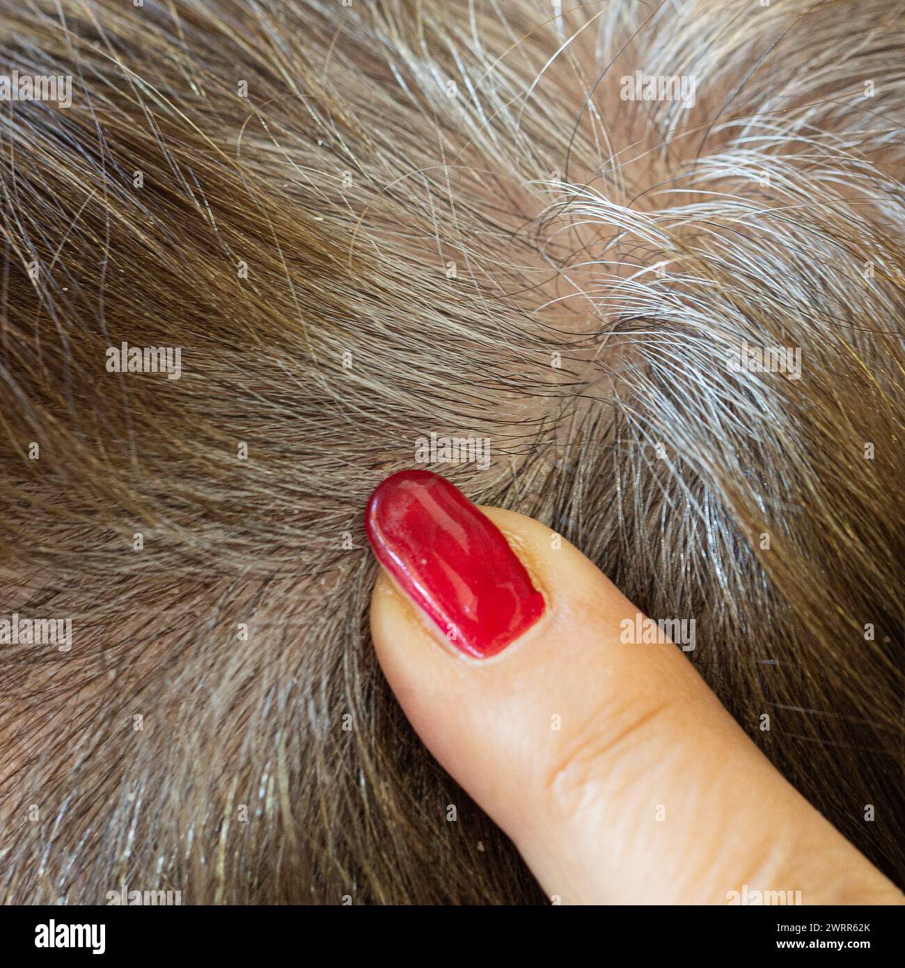 A close-up view of a finger pointing to the noticeable white hair ...