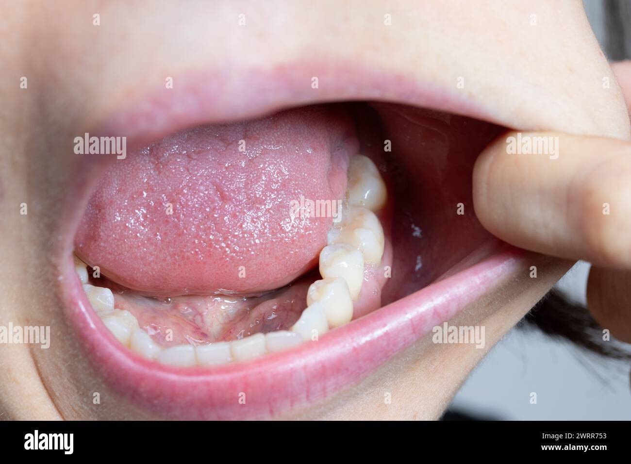 Detailed close-up view inside a mouth, showcasing healthy teeth and ...