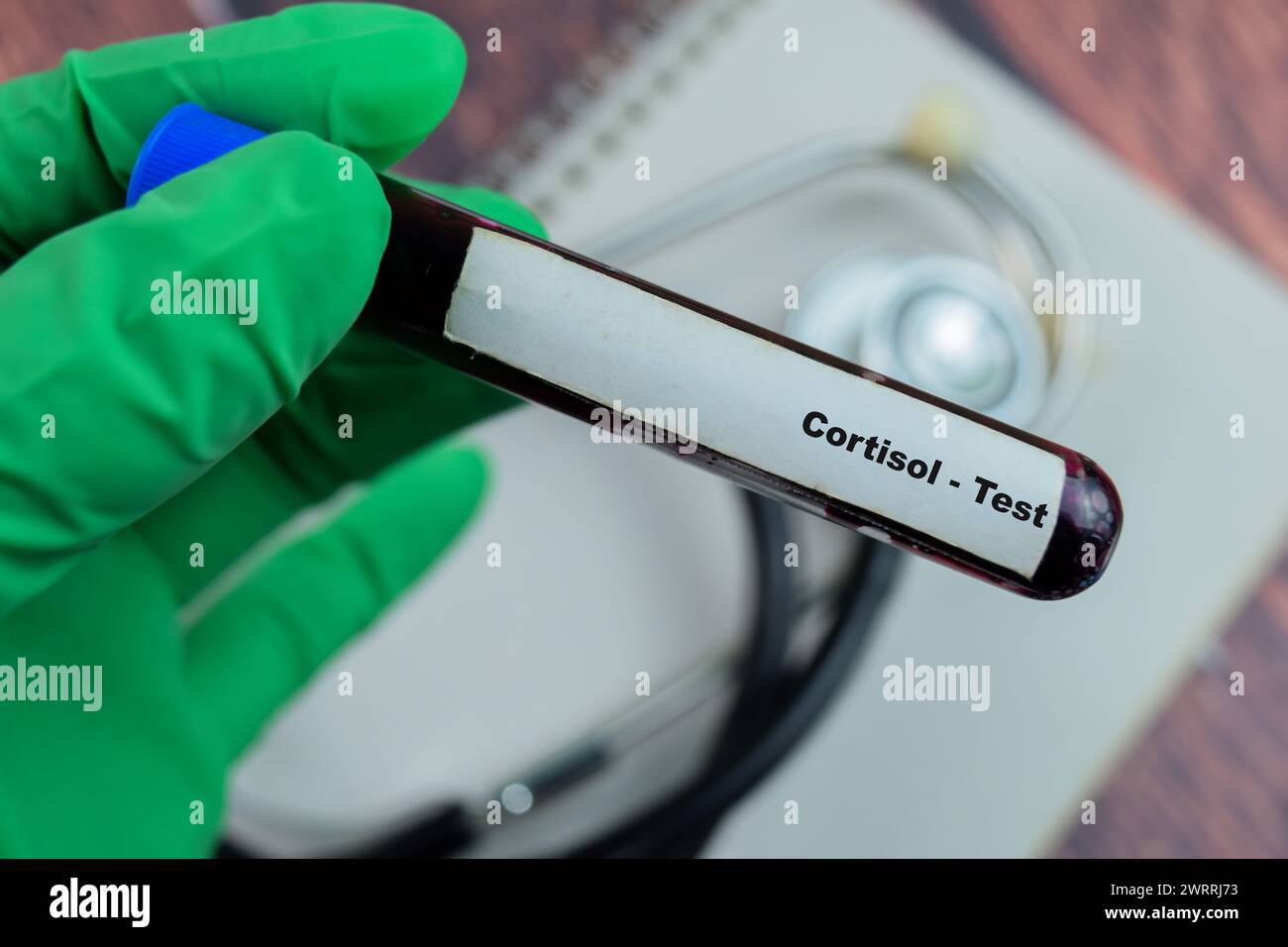 Cortisol assessment hi-res stock photography and images - Alamy