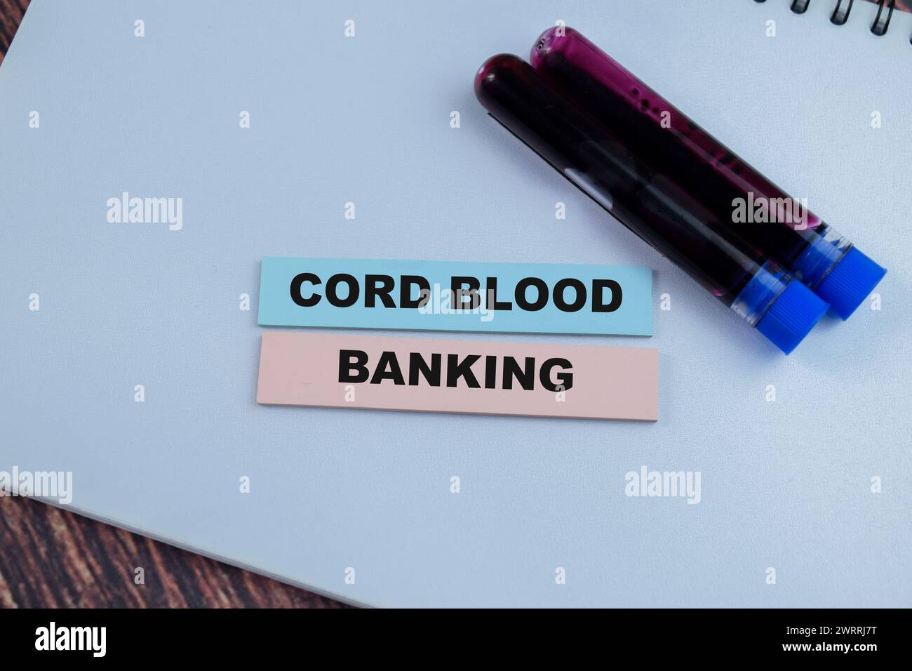 Umbilical cord anatomy hi-res stock photography and images - Alamy