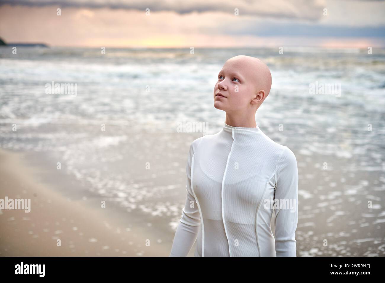 Close up portrait of young hairless girl with alopecia in white ...