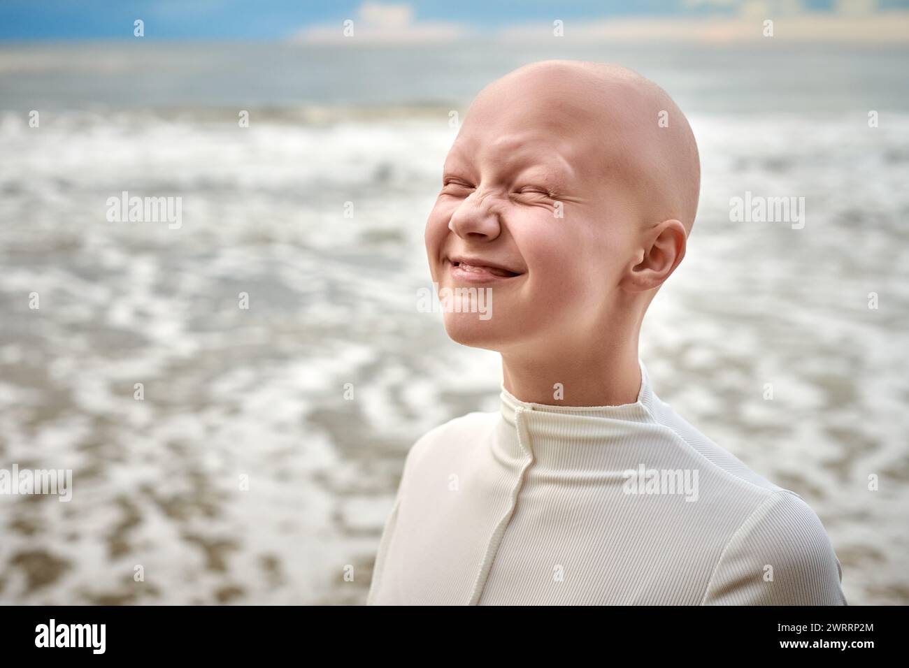 Hairless girl with alopecia make faces in white futuristic costume on ...