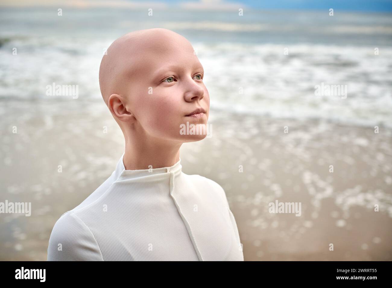 Close up portrait of young hairless girl with alopecia in white ...