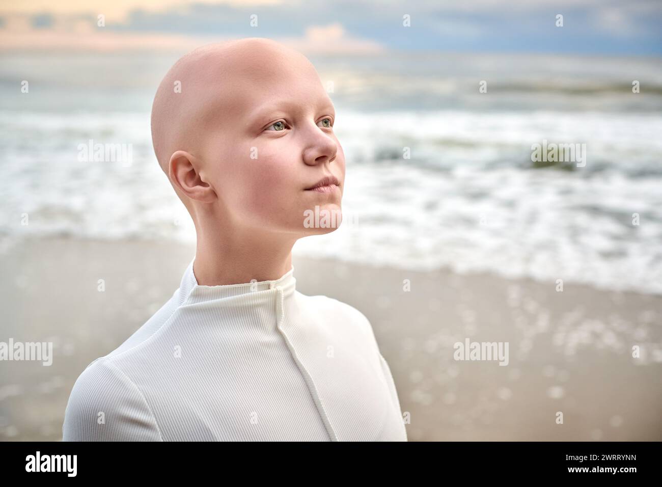 Close up portrait of young hairless girl with alopecia in white ...