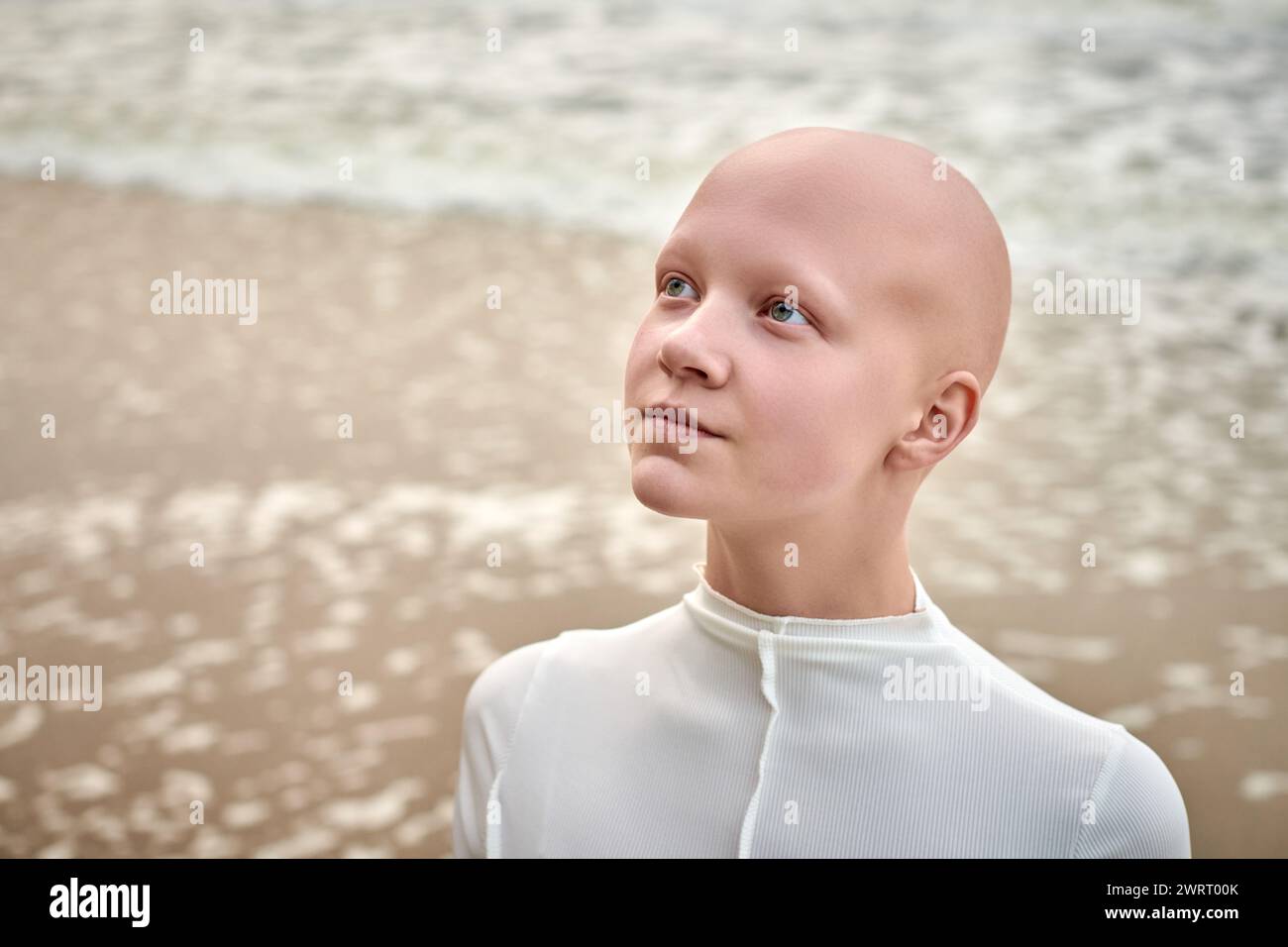 Close up portrait of young hairless girl with alopecia in white ...