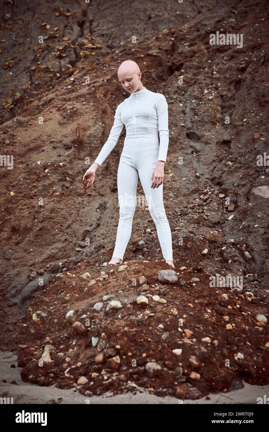 Full length portrait of young hairless girl with alopecia in white ...