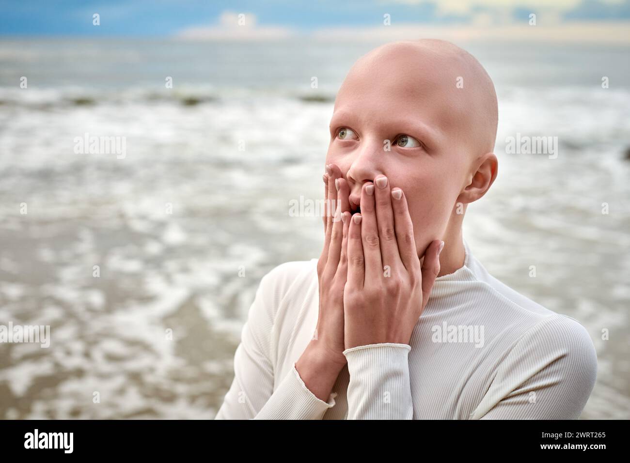 Hairless girl with alopecia make faces in white futuristic costume on ...