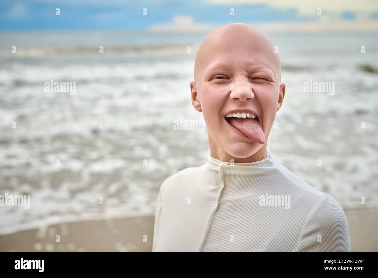 Hairless girl with alopecia make faces in white futuristic costume on ...