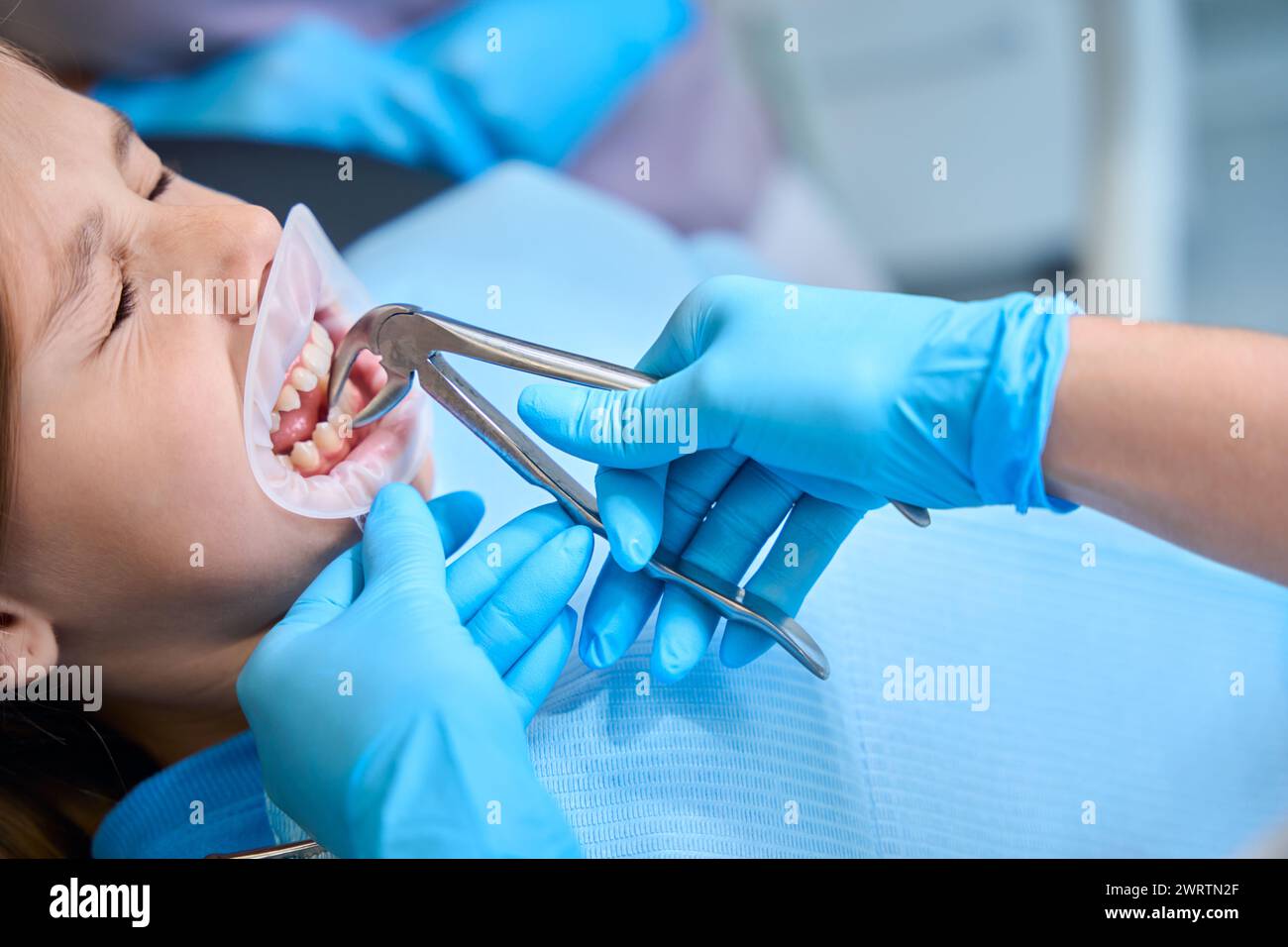 Doctor removes a girls tooth with a special tool Stock Photo - Alamy