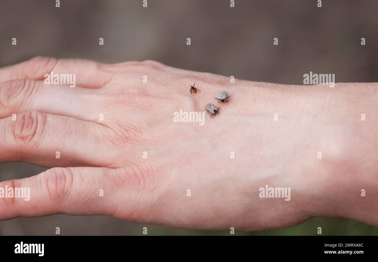 Three ticks sit on a man's hand in nature Stock Photo - Alamy
