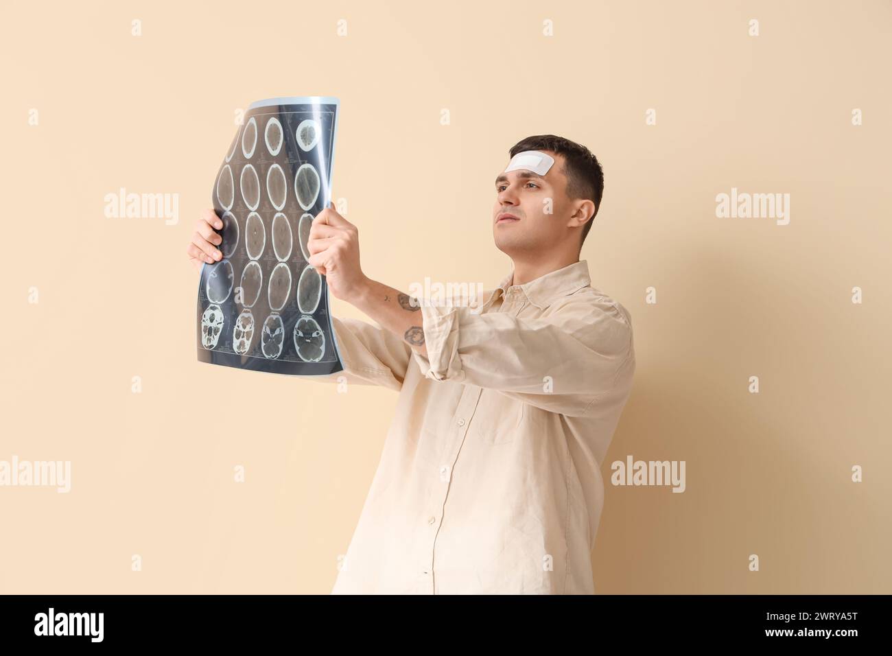 Young man with brain concussion and MRI scan on beige background Stock ...