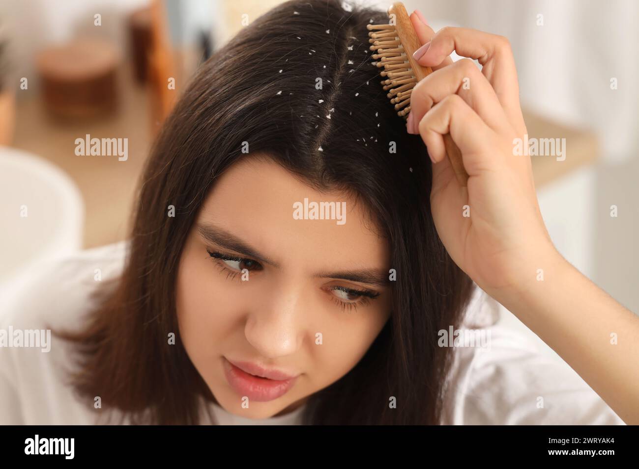Stressed young woman with dandruff problem combing hair in light ...