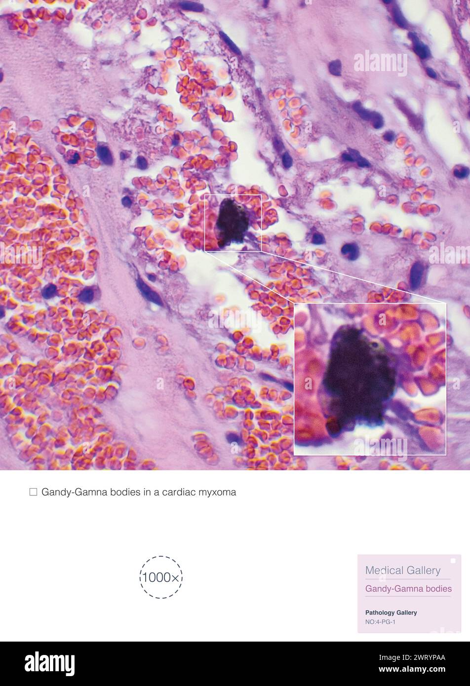 Gandy gamna nodules hi-res stock photography and images - Alamy