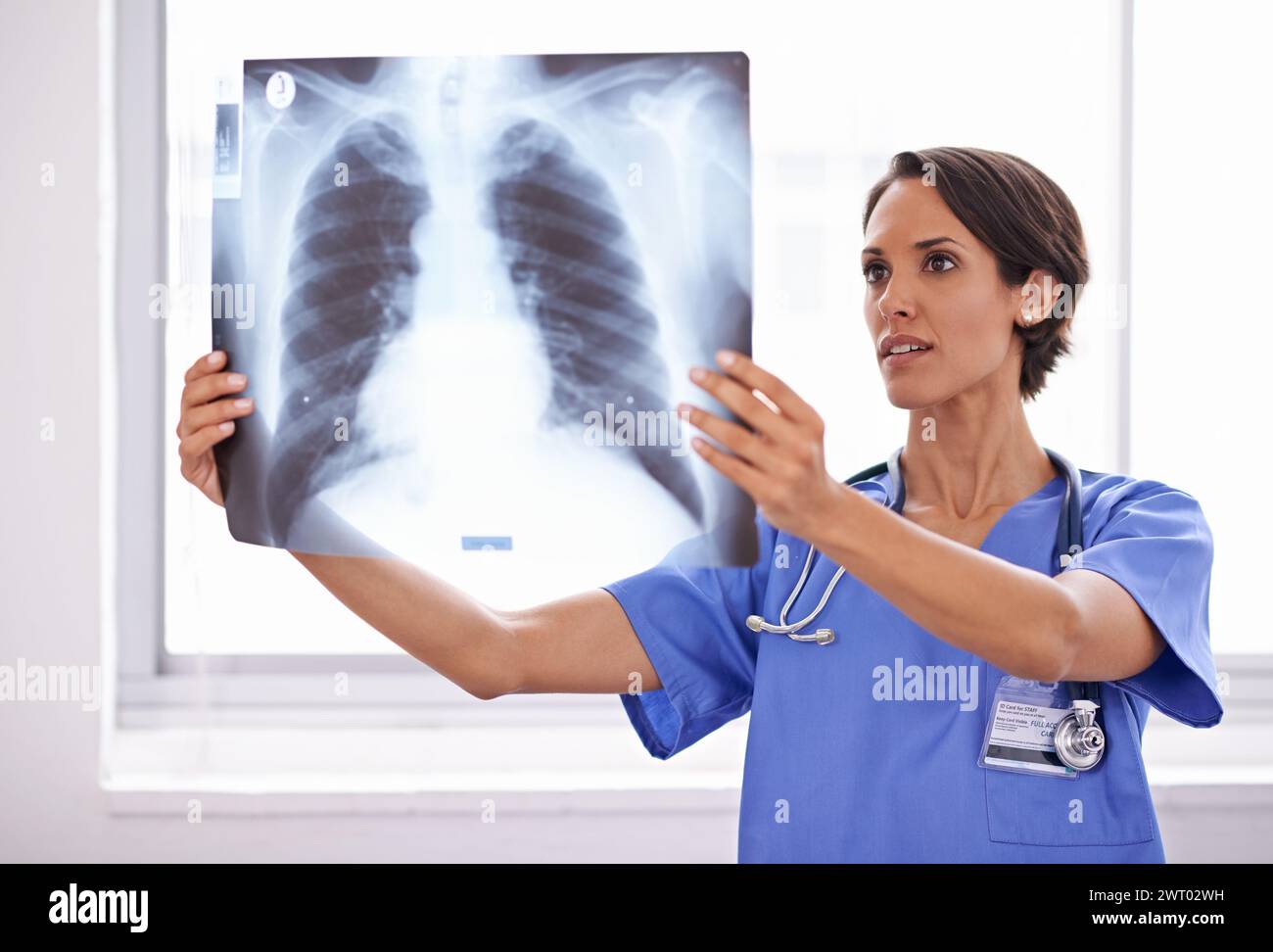 X ray, hospital and woman doctor thinking of healthcare research ...