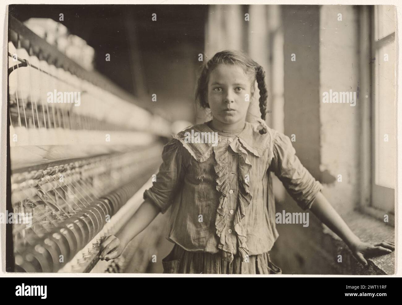 Almost no hair hi-res stock photography and images - Alamy