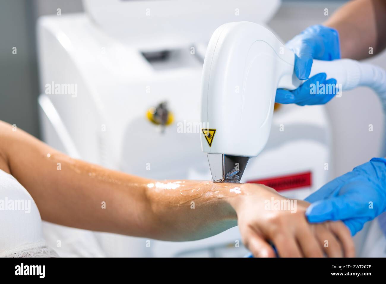 Woman in a beauty salon removes hair from her arm with laser epilation ...