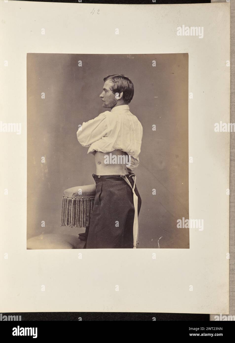 Recovery after Penetrating Gunshot Wound of the Abdomen, with Faecal ...