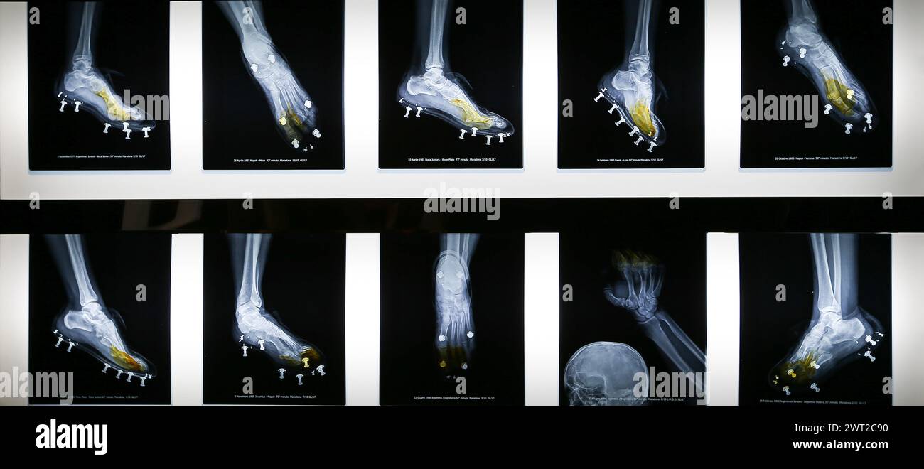 Piede a piedi hi-res stock photography and images - Alamy