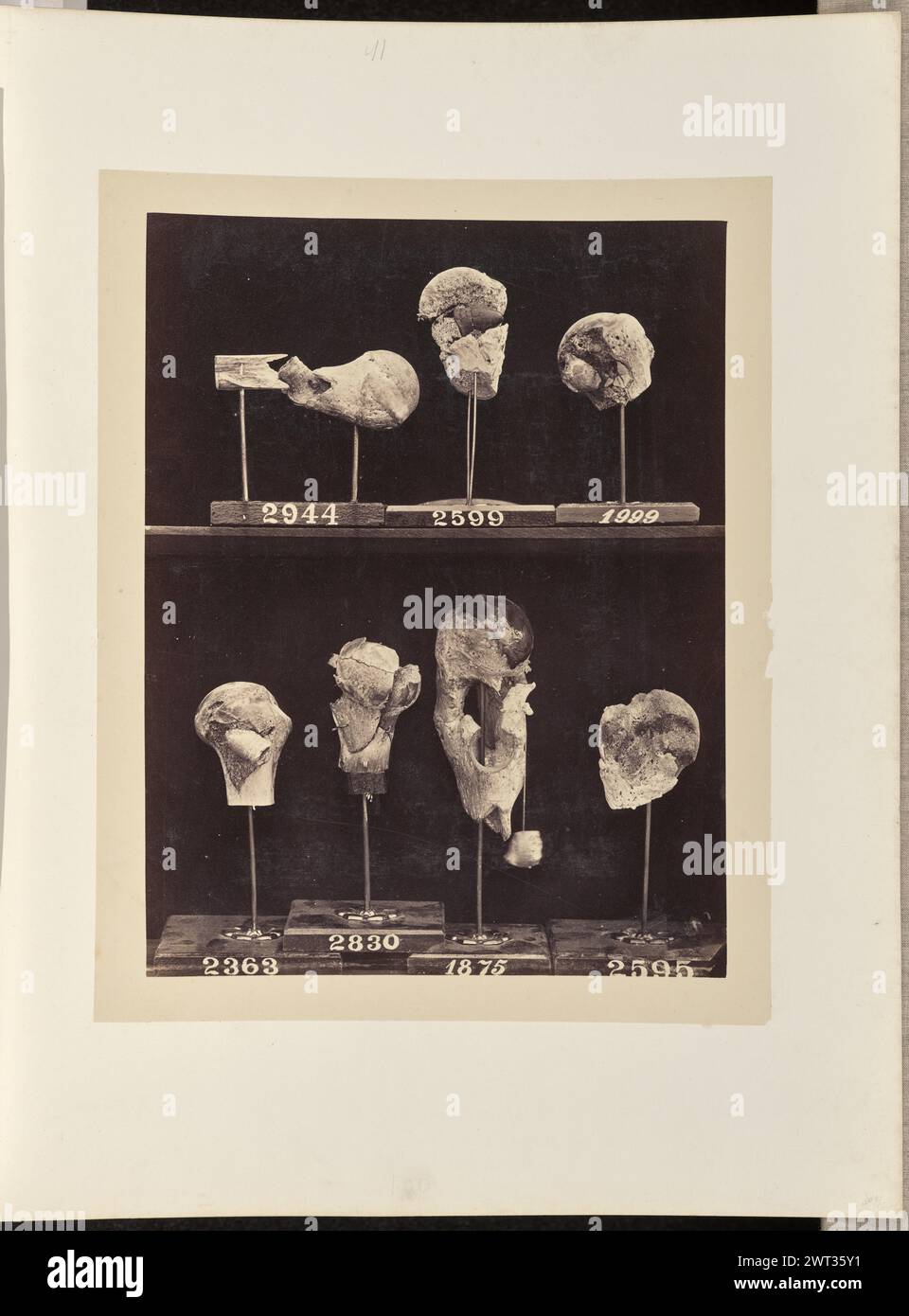 Seven Heads of Humeri excised for Gunshot Injuries. Possibly William H ...