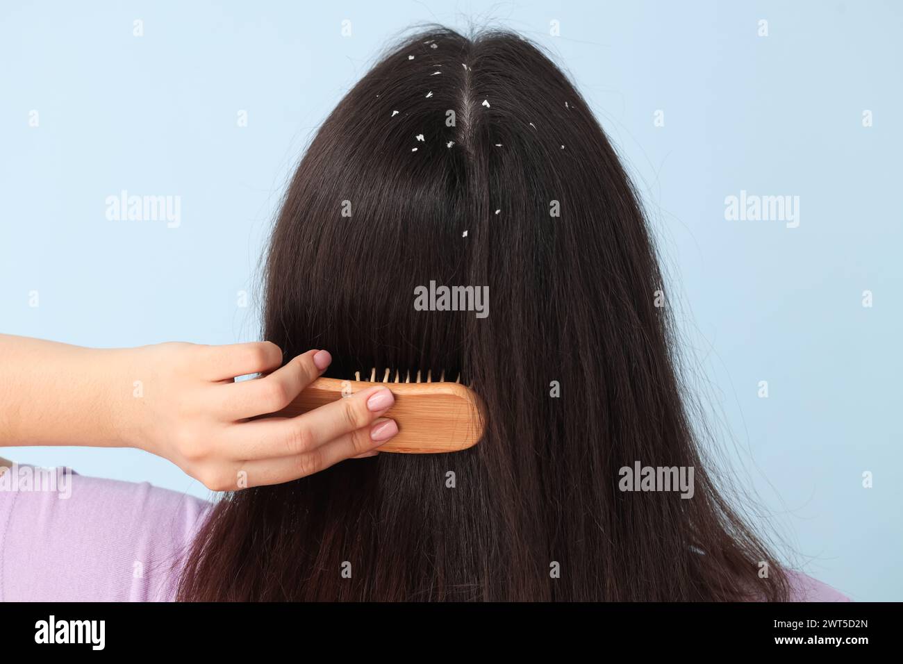 Young woman with dandruff problem combing hair on blue background, back ...