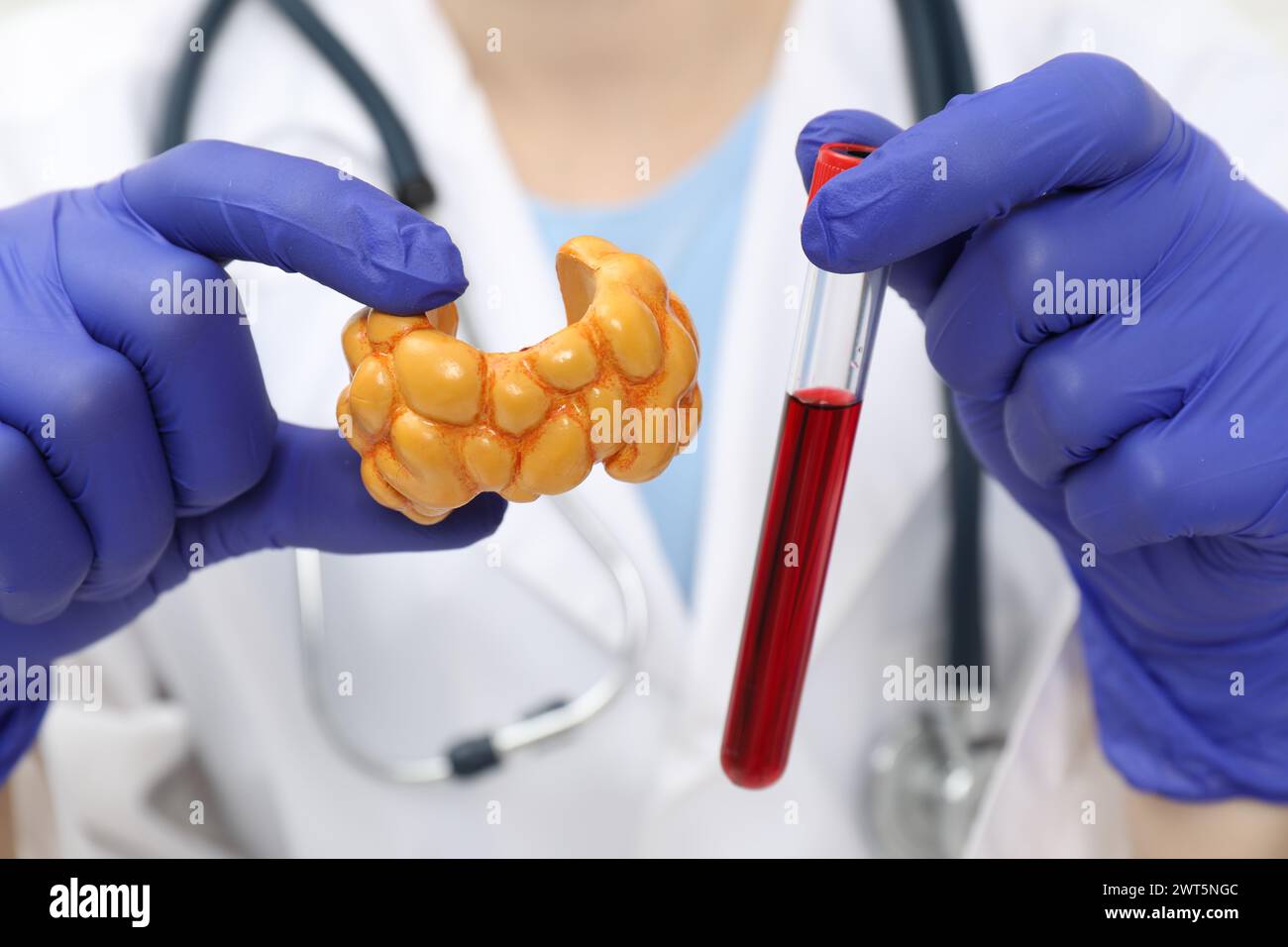 Endocrinologist showing thyroid gland model and blood sample in test ...