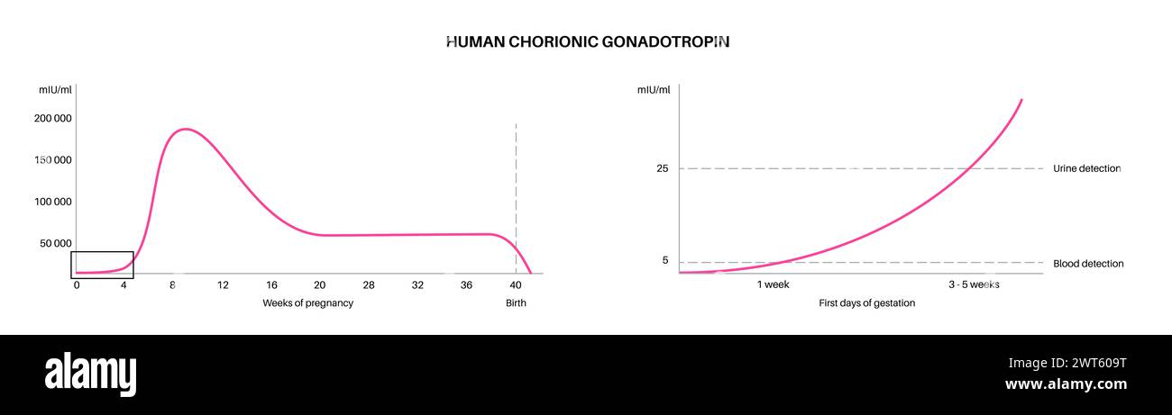 Human chorionic gonadotropin (hCG) infographic, illustration Stock ...