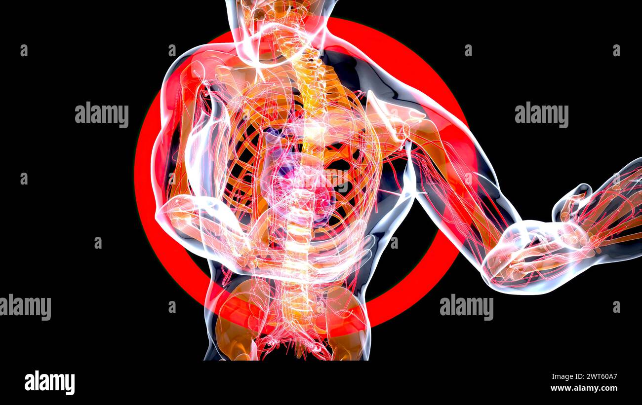 Heart attack, conceptual illustration Stock Photo - Alamy