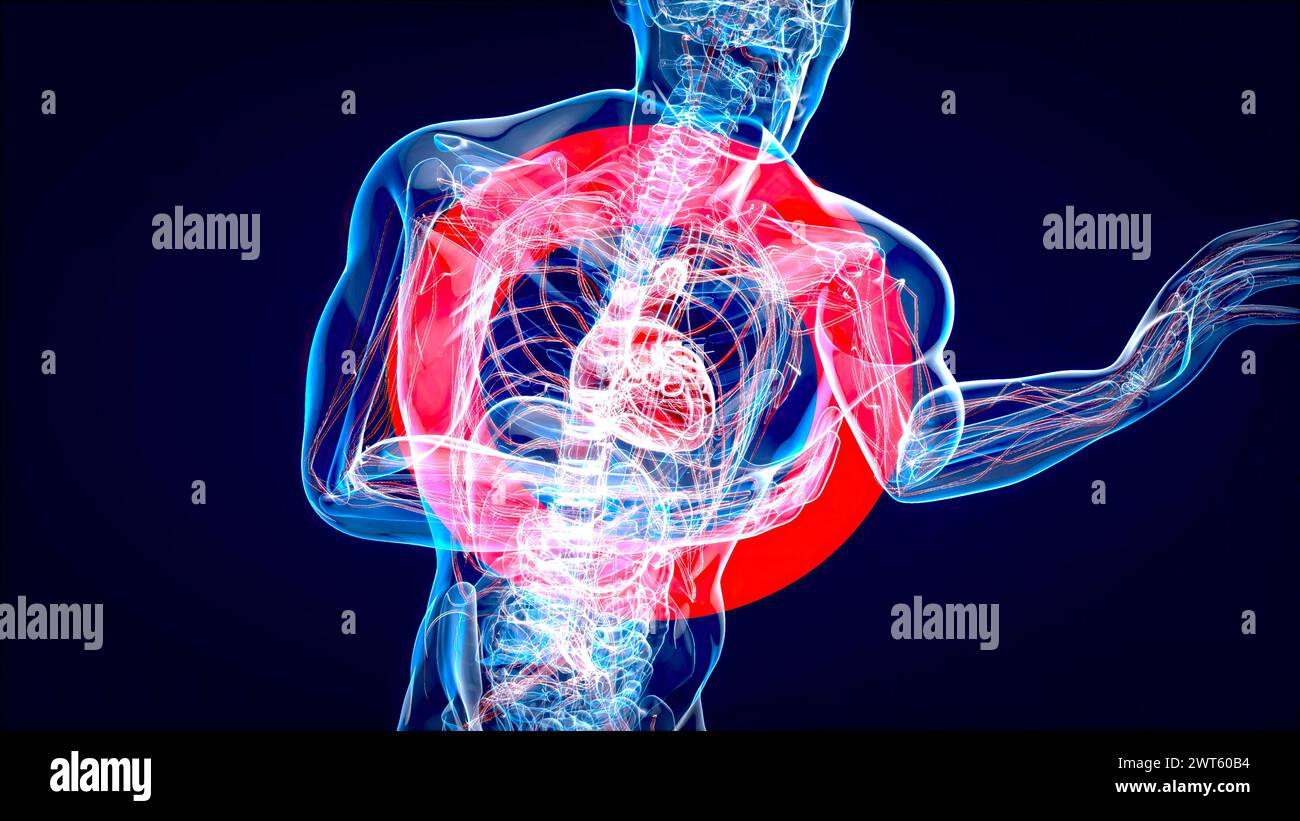 Heart attack, conceptual illustration Stock Photo - Alamy