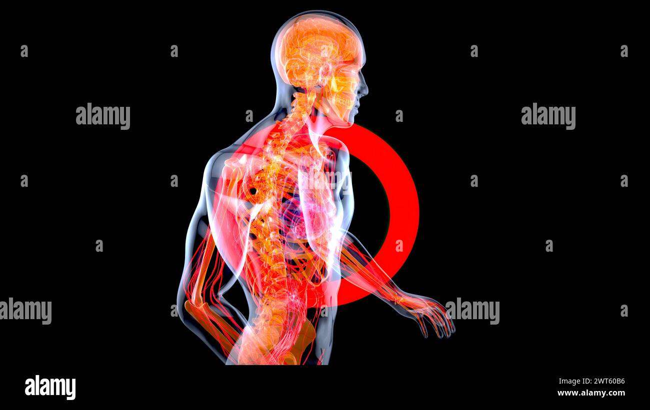 Heart attack, conceptual illustration Stock Photo - Alamy