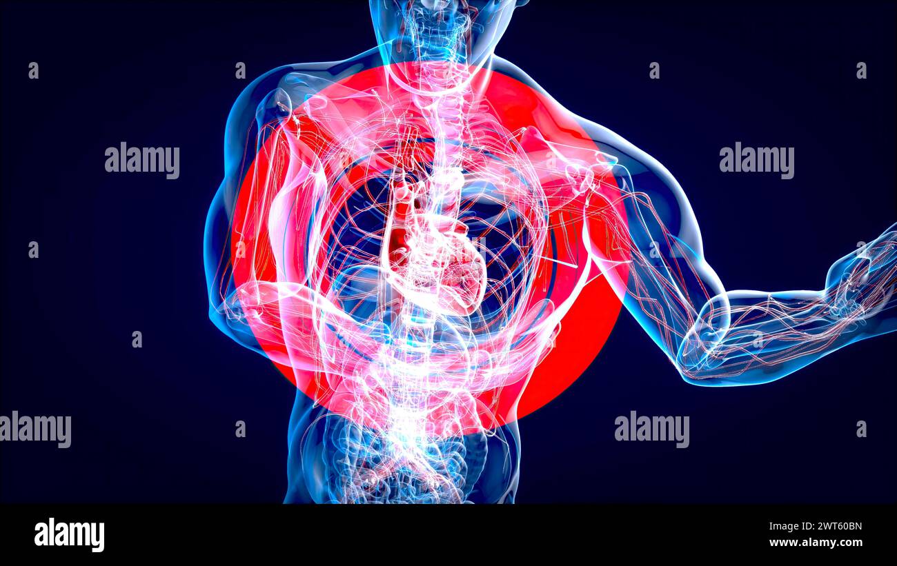 Heart attack, conceptual illustration Stock Photo - Alamy
