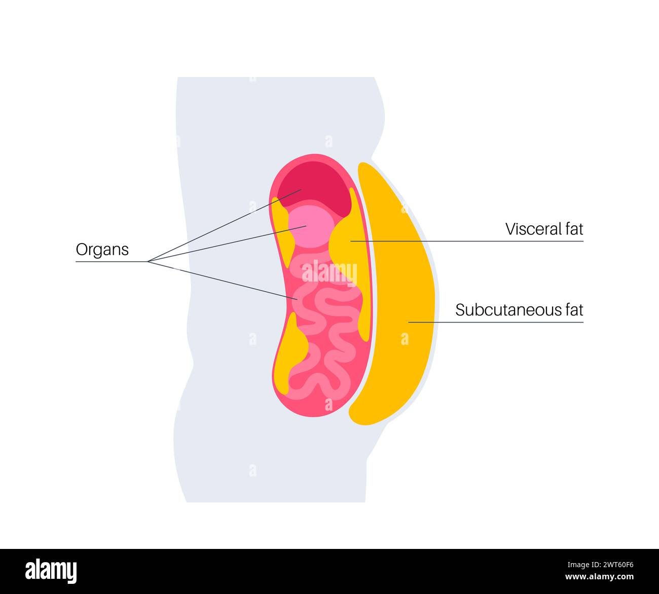 Visceral fat diagram, illustration. Belly fat surrounds internal organs ...