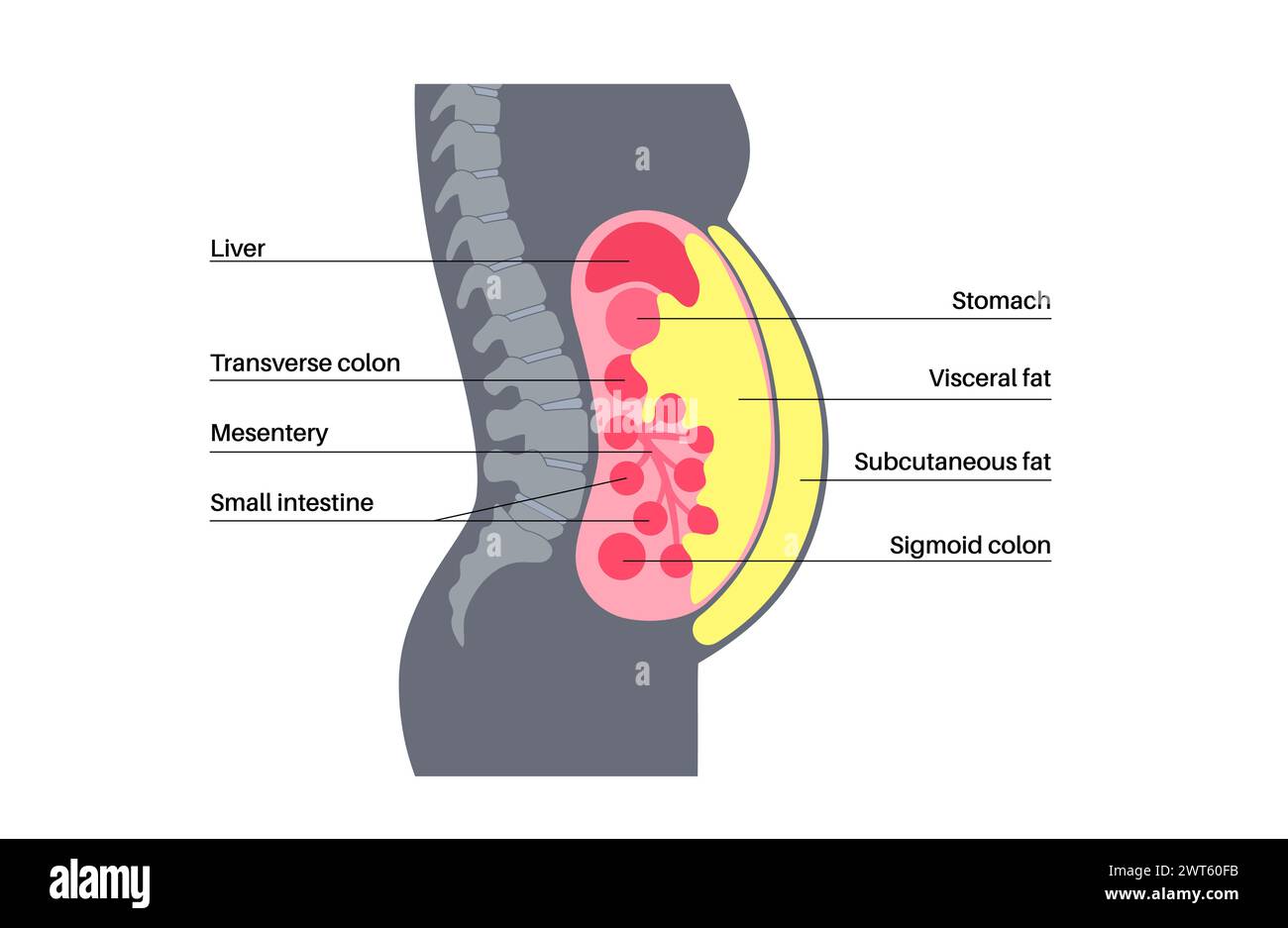 Visceral fat diagram, illustration. Belly fat surrounds internal organs ...