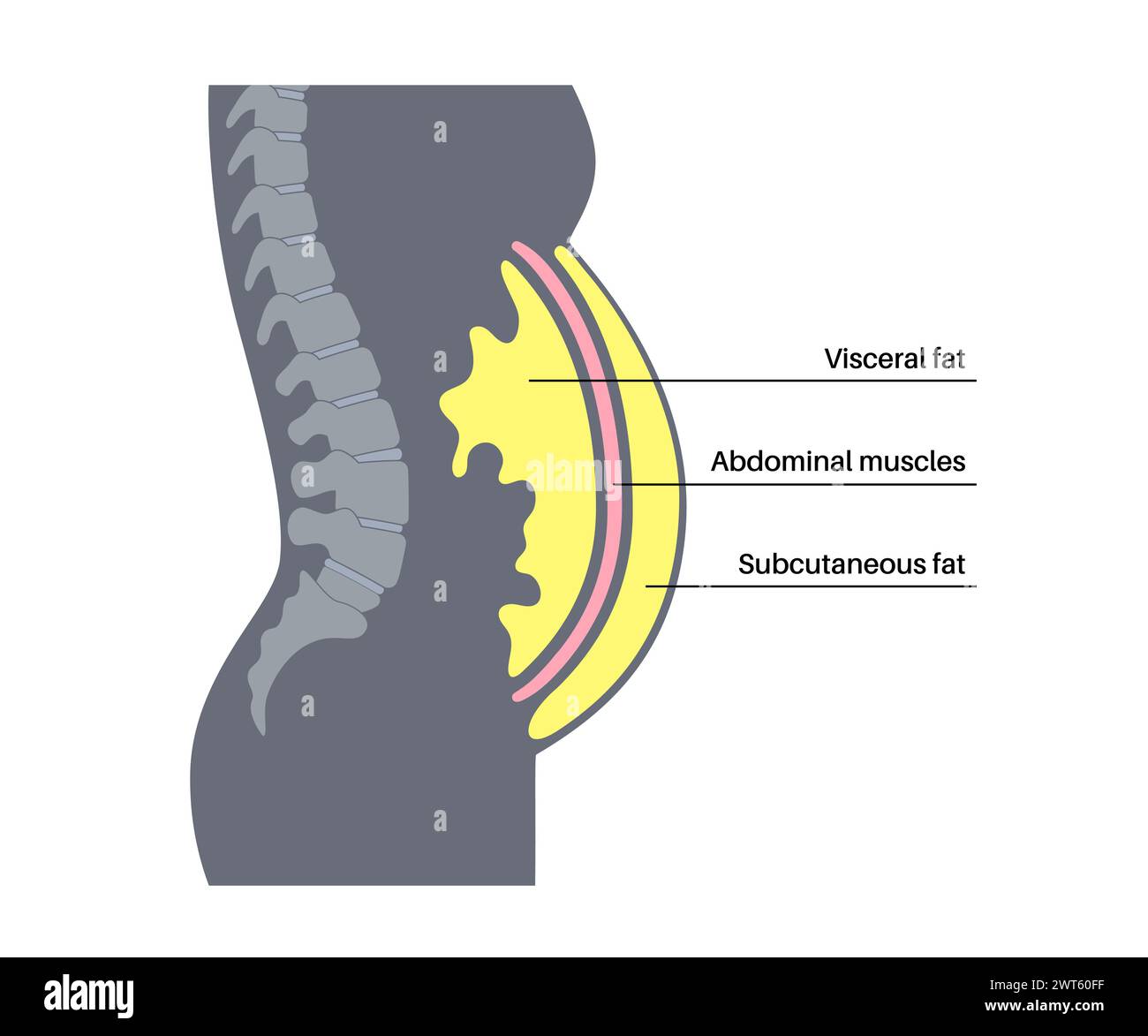 Visceral fat diagram, illustration. Belly fat surrounds internal organs in abdominal cavity ...