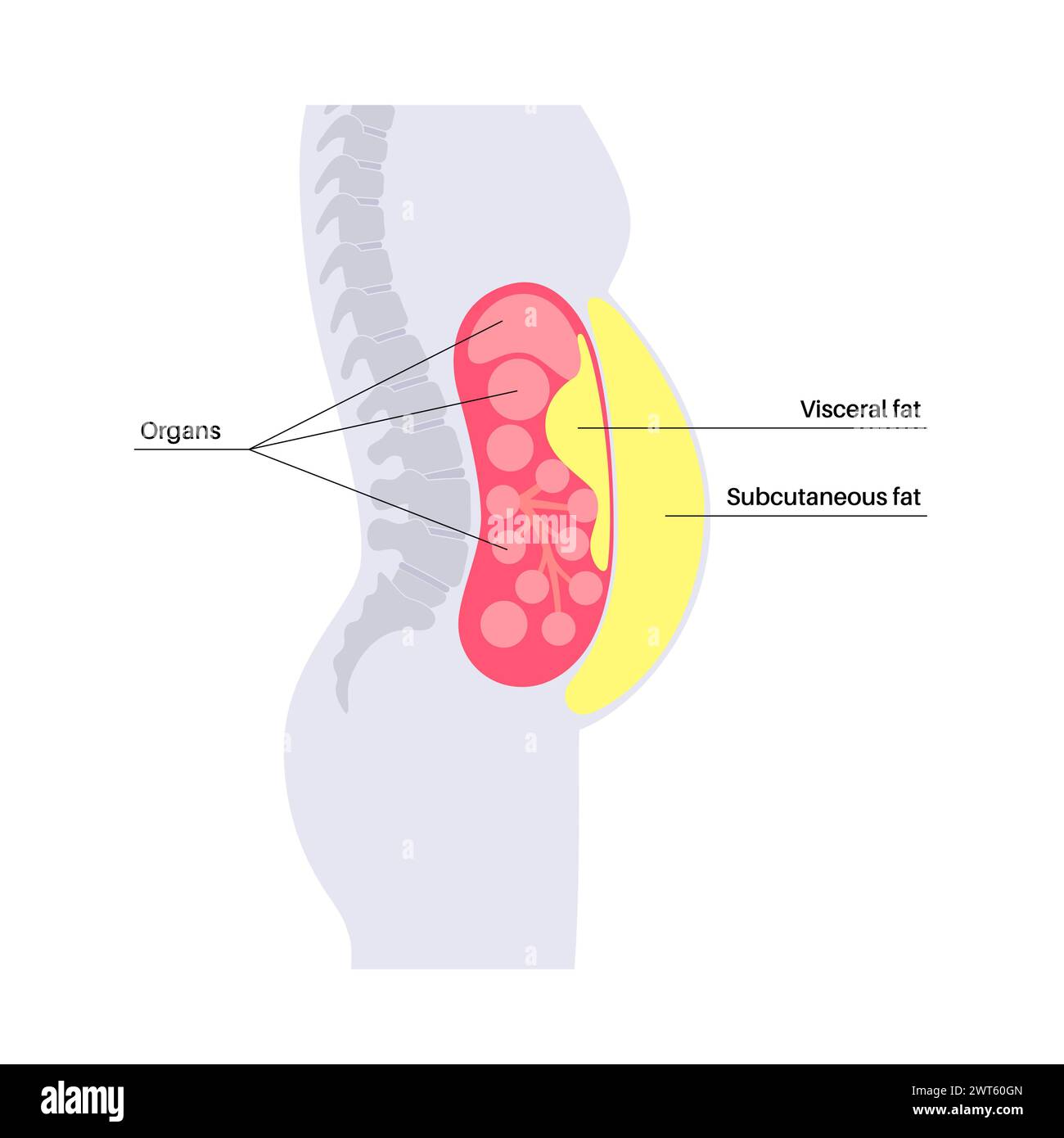 Visceral fat diagram, illustration. Belly fat surrounds internal organs ...