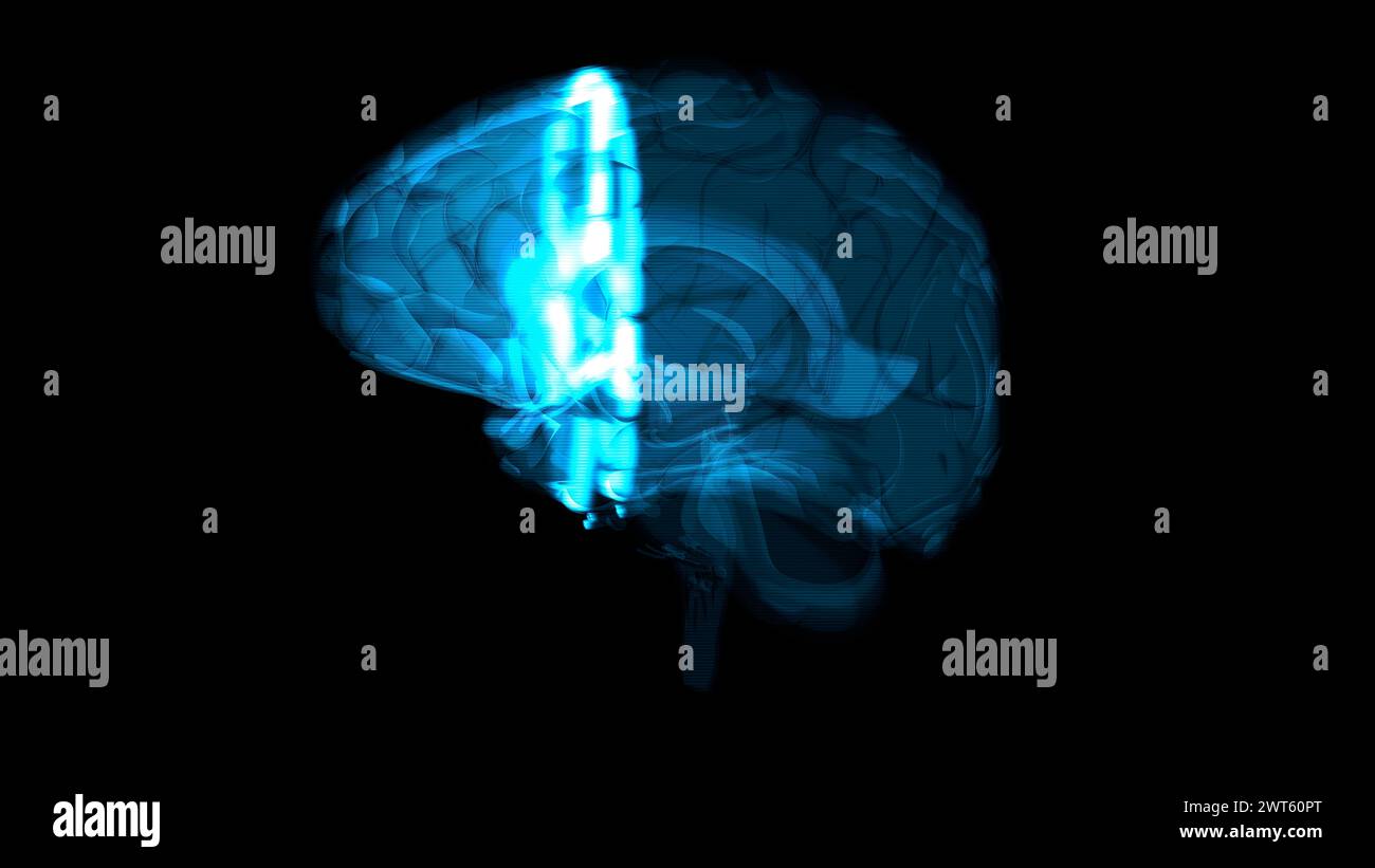 Brain scan, conceptual illustration Stock Photo - Alamy