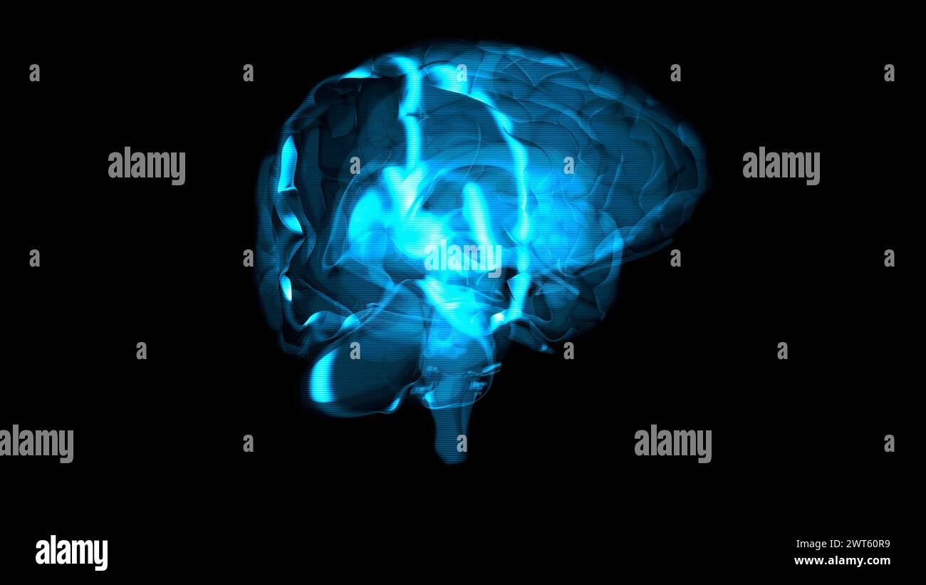 Brain scan, conceptual illustration Stock Photo - Alamy