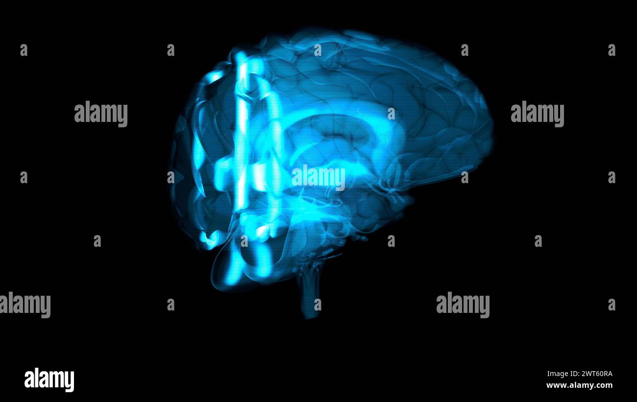 Brain scan, conceptual illustration Stock Photo - Alamy